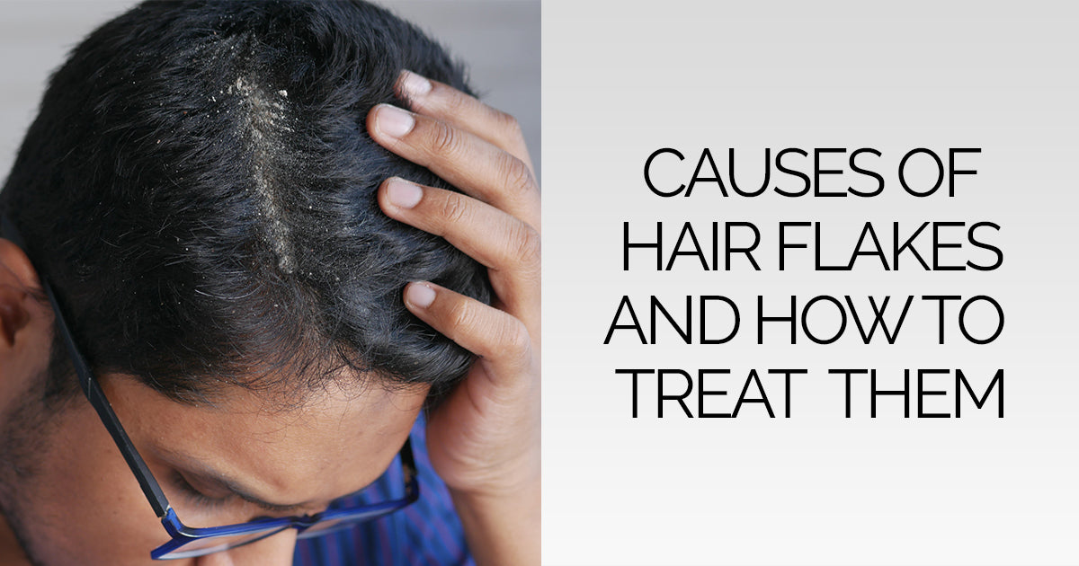 What’s Causing Flakes in Your Hair and How to Treat Them
